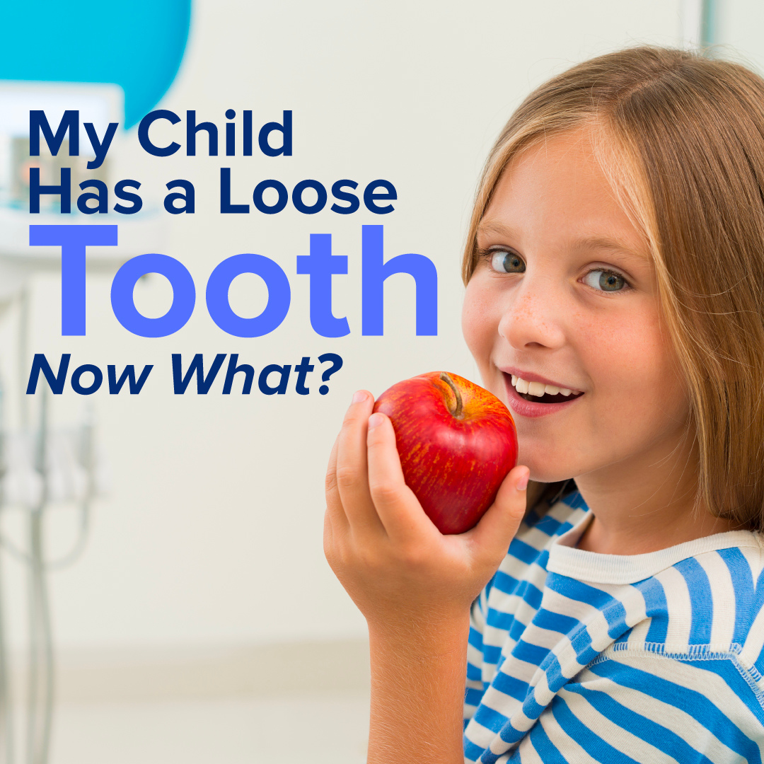 My Child Has a Loose Tooth in Albuquerque, NM—Now What? | ABQ Dentistry ...